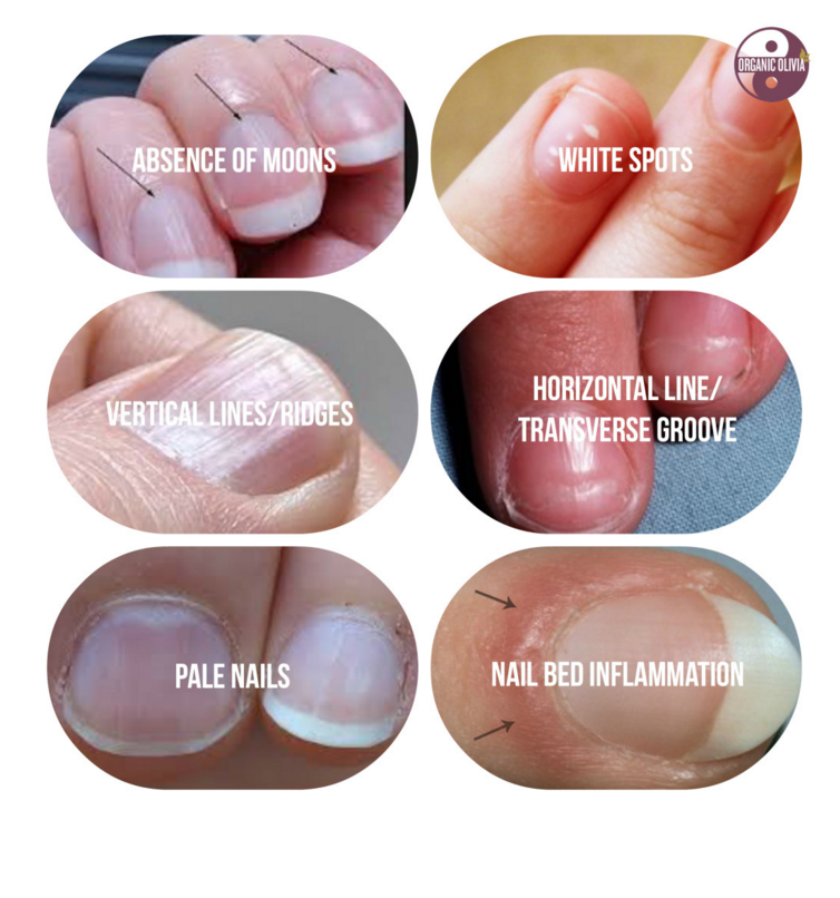 6 Signs Your Fingernails Are Trying To Tell You Something - Organic ...