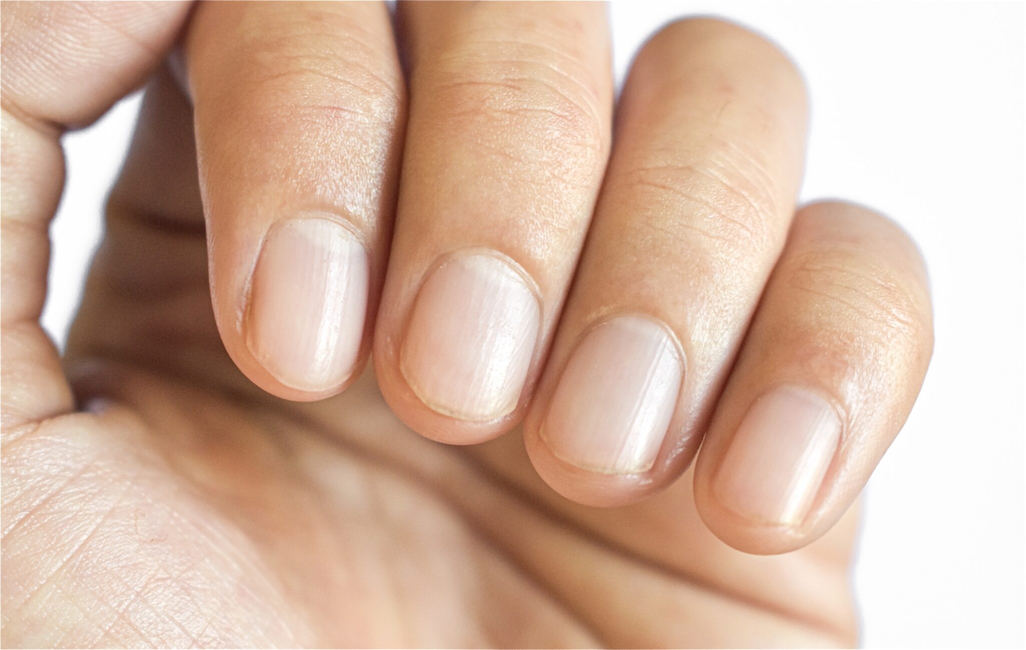 6 Signs Your Fingernails Are Trying To Tell You Something - Organic ...