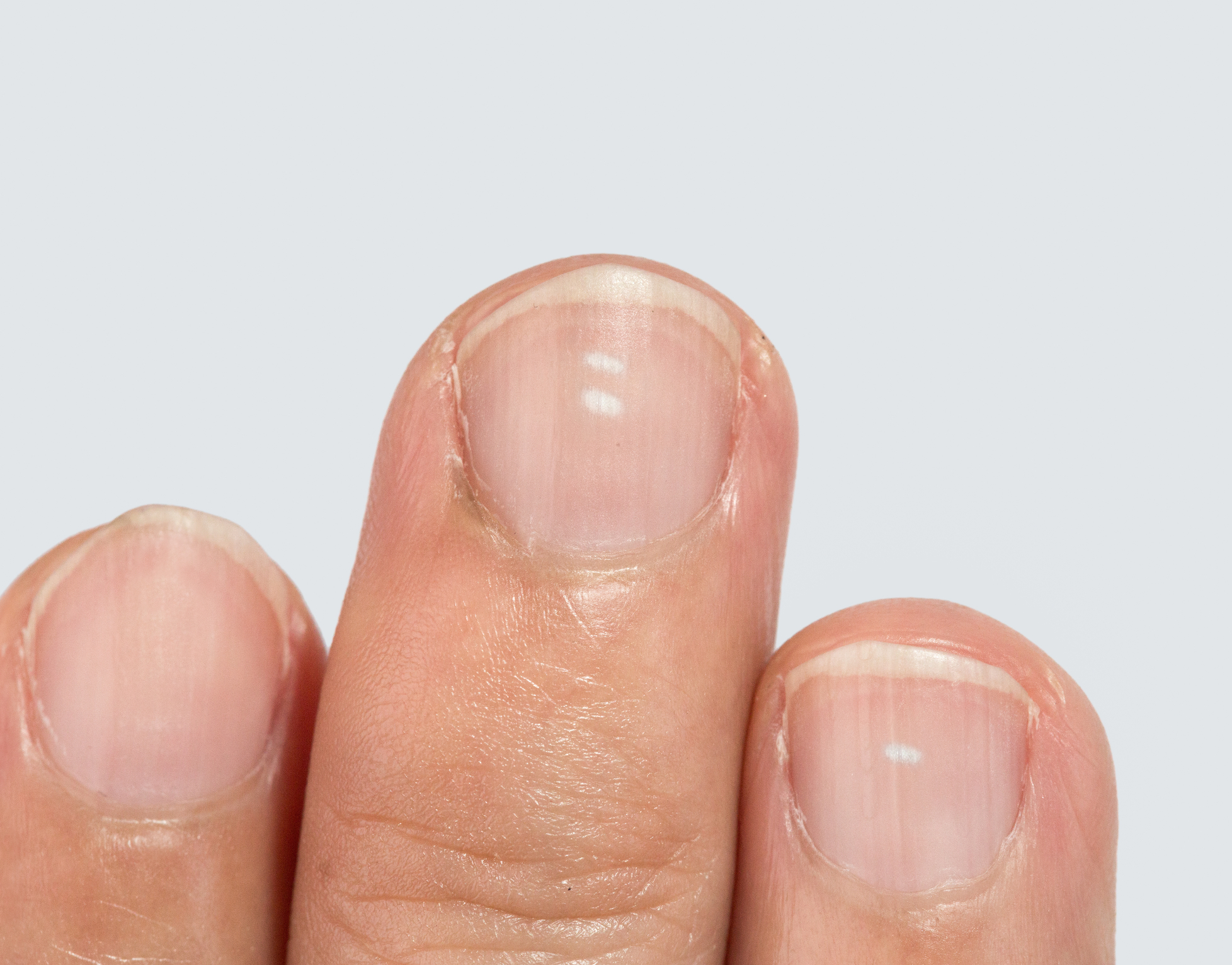6 Signs Your Fingernails Are Trying To Tell You Something - Organic ...