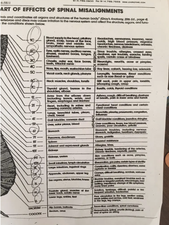 [VIDEO] The Shocking X-Ray of My Spine + Interview with Chiropractors ...